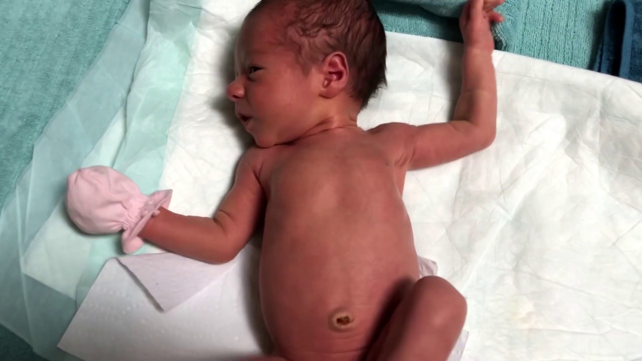 4 Days After UMBILICAL CORD FELL OFF Newborn Baby Lotus Birth Home 4-days-after-umbilical-cord-fell-off-newborn-baby-lotus-birth-home