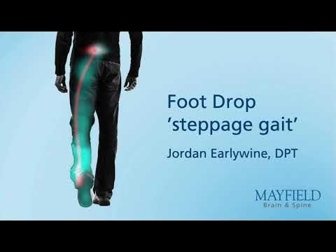 Foot Drop "steppage gait" - YouTube
