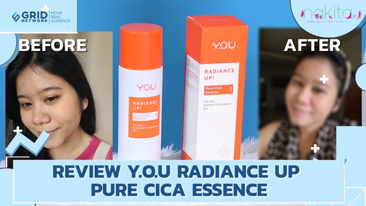 Review Y.O.U Radiance Up Pure Cica Essence di Kulit Kering Selama 1 ...