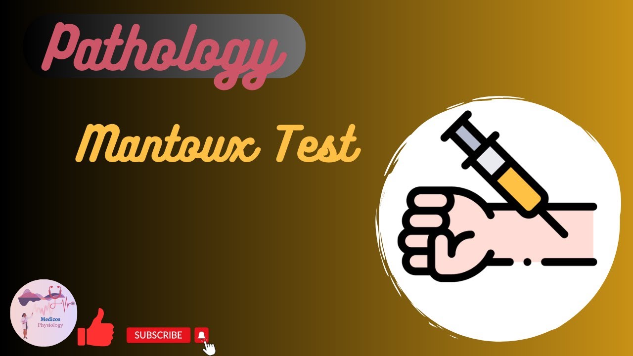 Mantoux Test YouTube mantoux-test-youtube