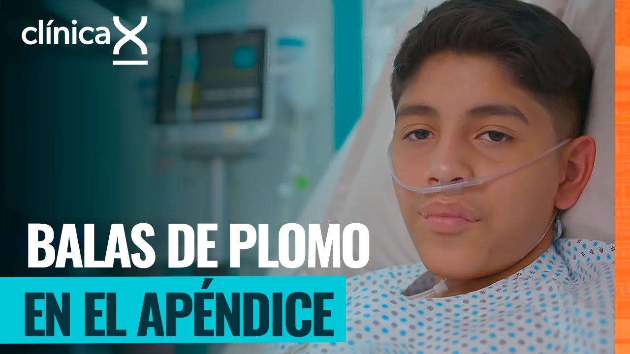 La operación del apéndice muestra un increíble descubrimiento | Clínica ...