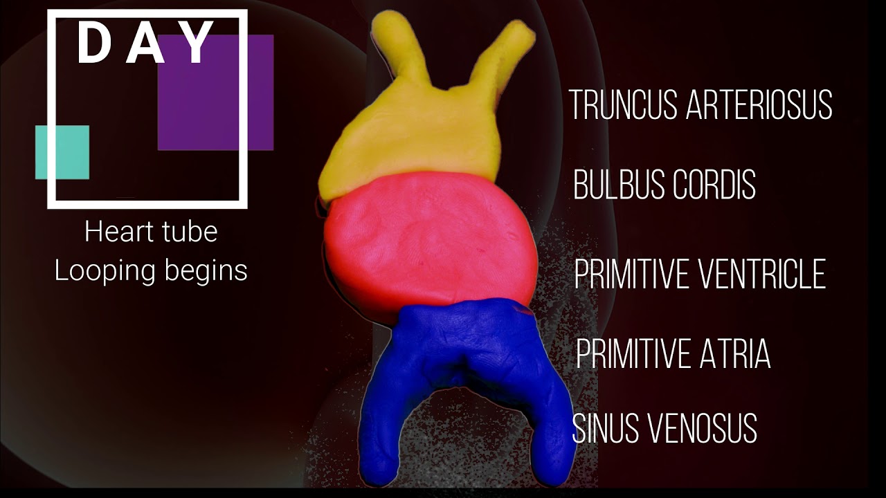Heart Tube Looping CHD Valeria and Rafael - YouTube