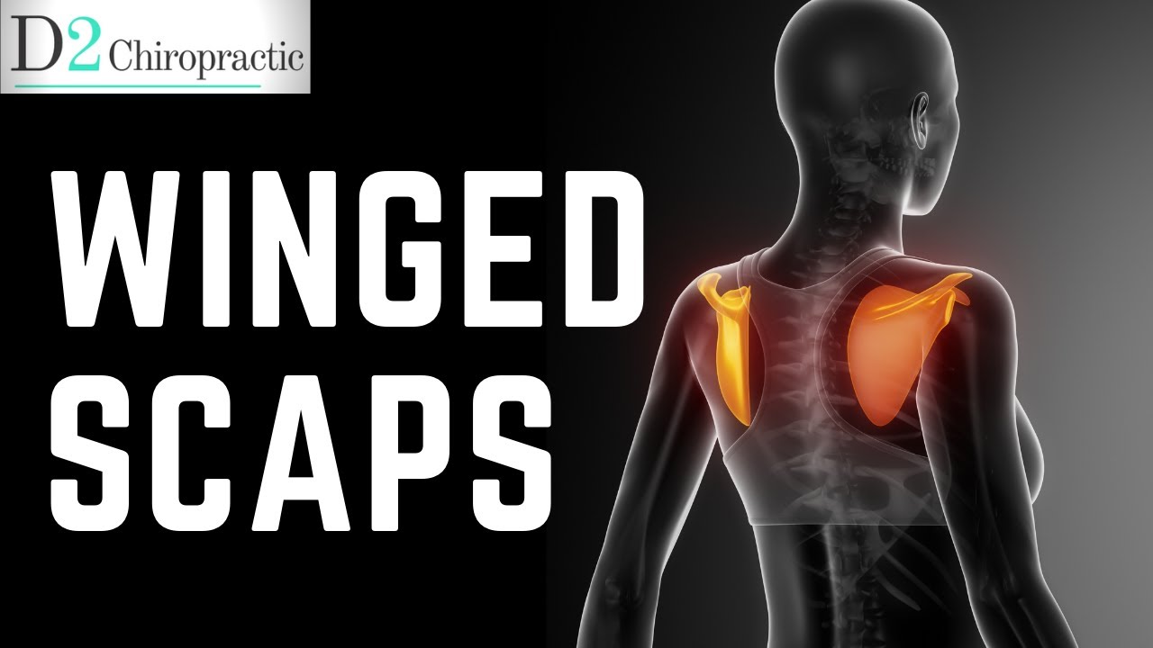 Winging Scapulae : Serratus Anterior & Lower Trap Strengthening - YouTube