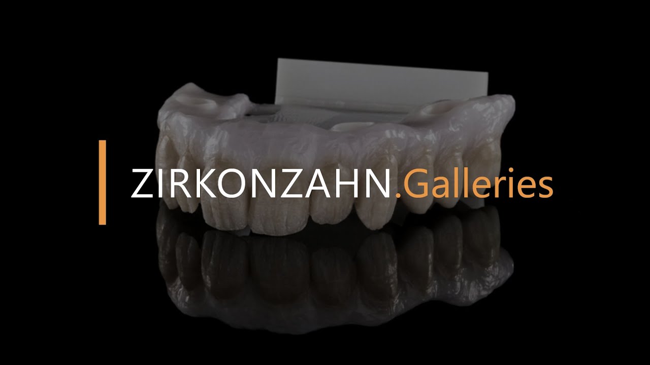 Prettau® Bridge on 4 implants | Zirkonzahn.Galleries - YouTube