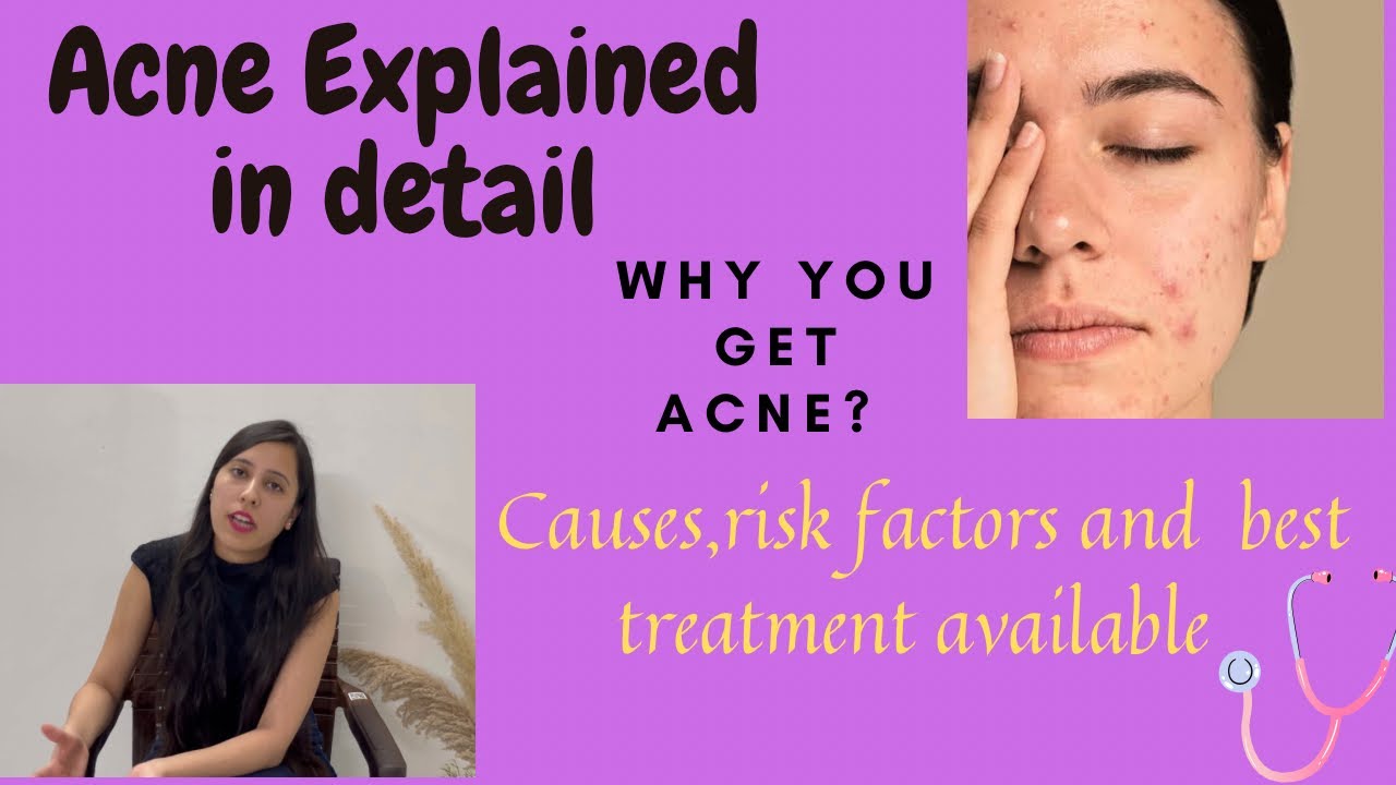 Acne explained in detail| Causes | Risk factors | Pathophysiology ...