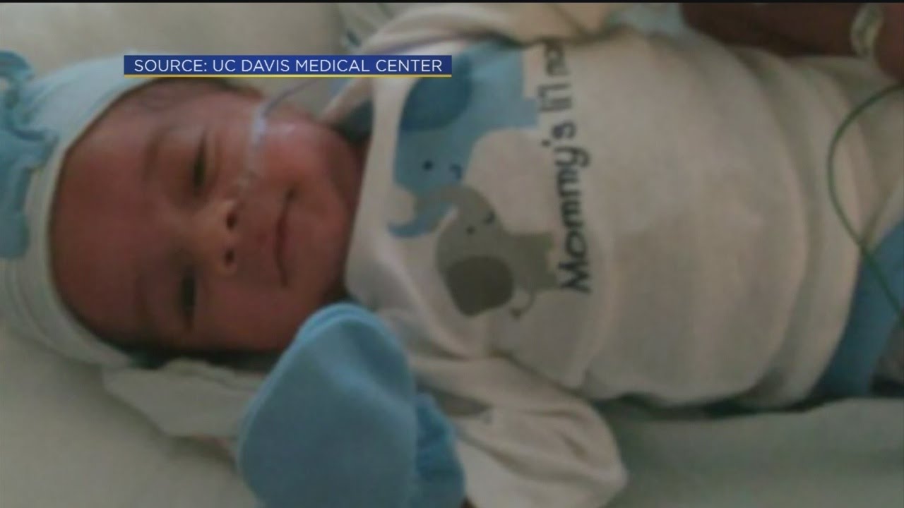 UC Davis Doctors Perform Surgery On Baby Still In The Womb - YouTube