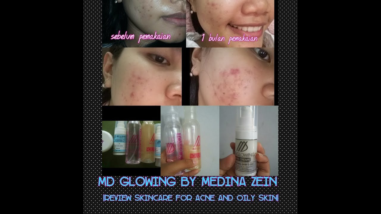 MD GLOWING | MD CLINIC| Review Acne White Product | GLOWING dan Putih ...