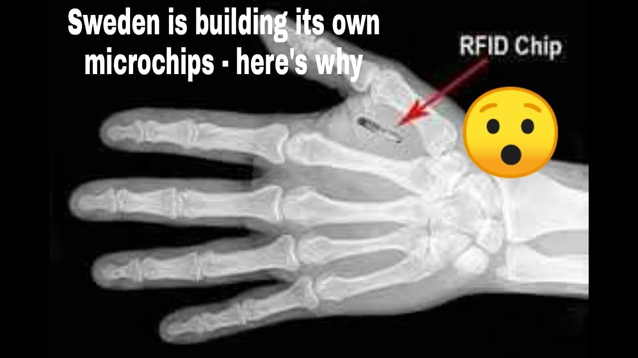 Thousands Of Swedes Are Inserting Microchips Under Their Skin #ptk97 ...