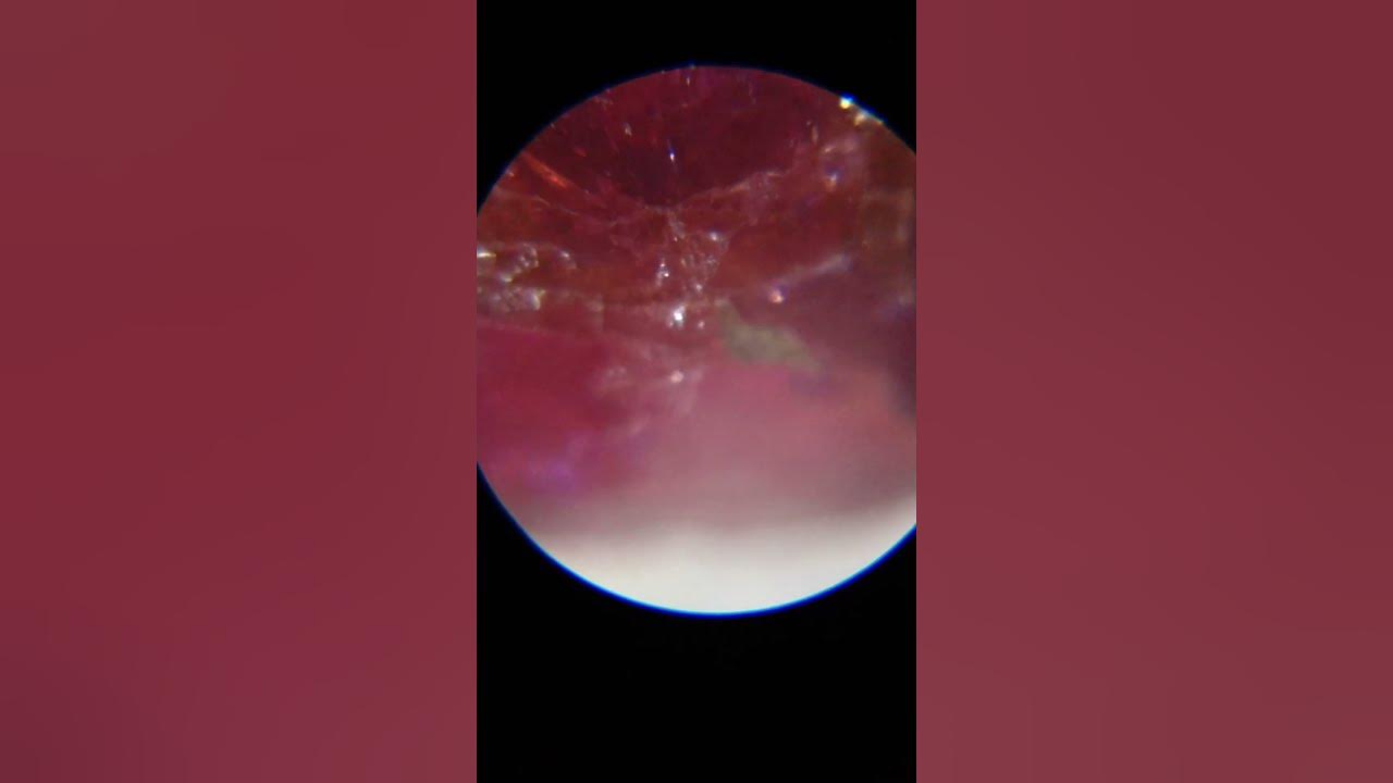 jeweler's ( Ruby ) gem microscope ancient🔬💎💎💎 - YouTube