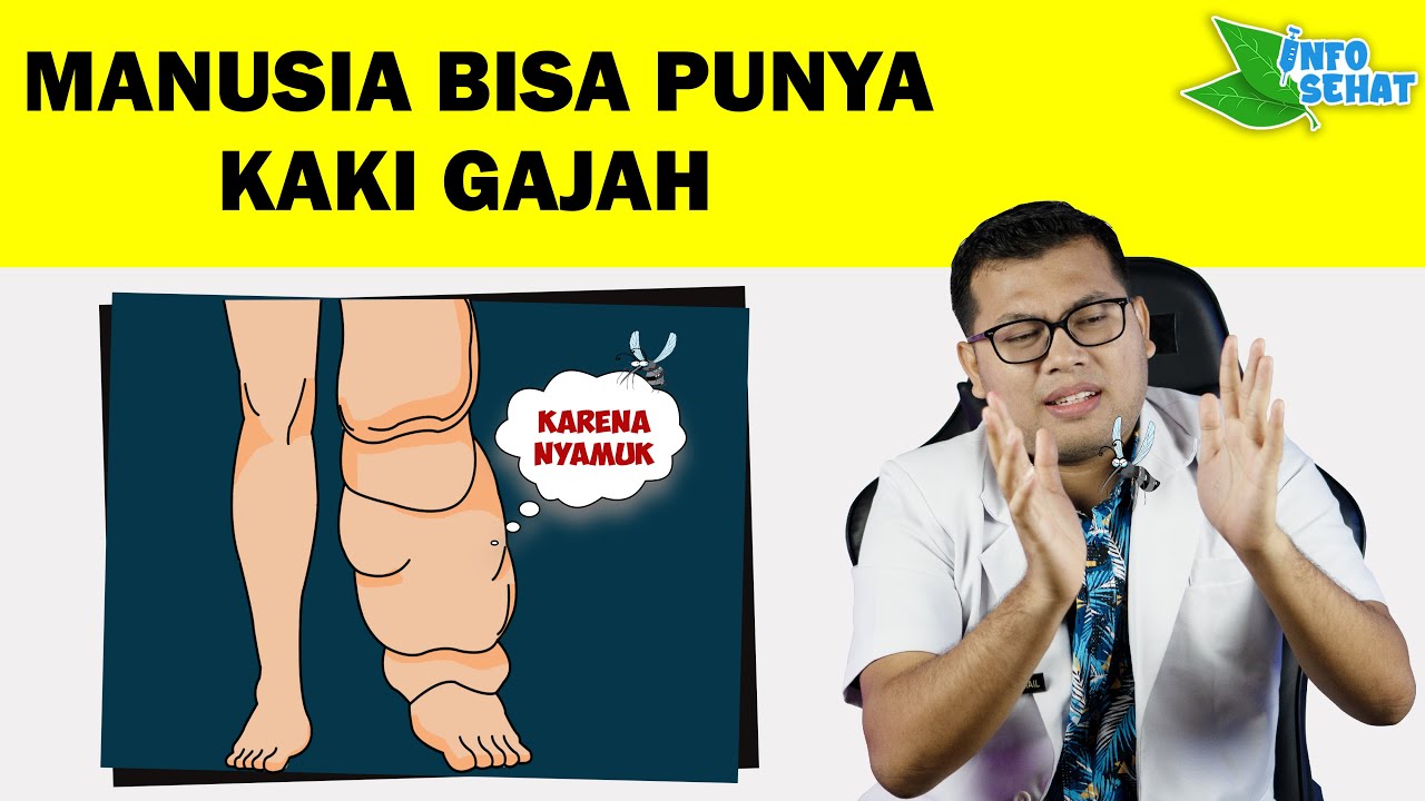 KAKI GAJAH - DOKTER SADDAM ISMAIL - YouTube