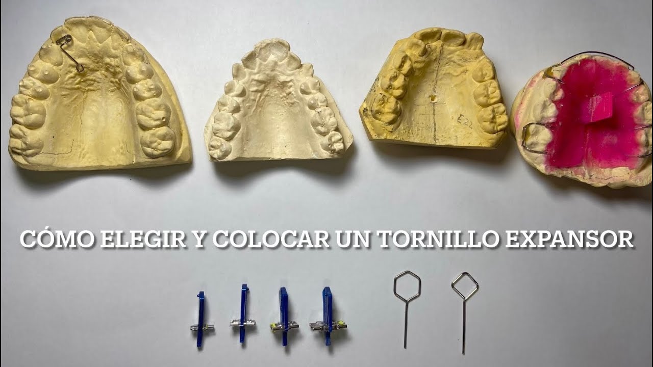 Cómo elegir y colocar un Tornillo Expansor - YouTube