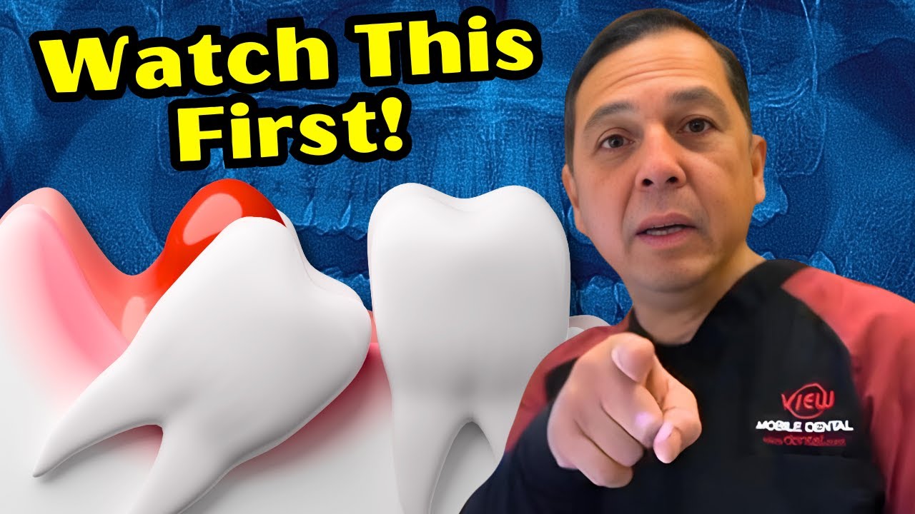 Wisdom Tooth 101: Dentist Explains Symptoms, Causes, and Treatment ...