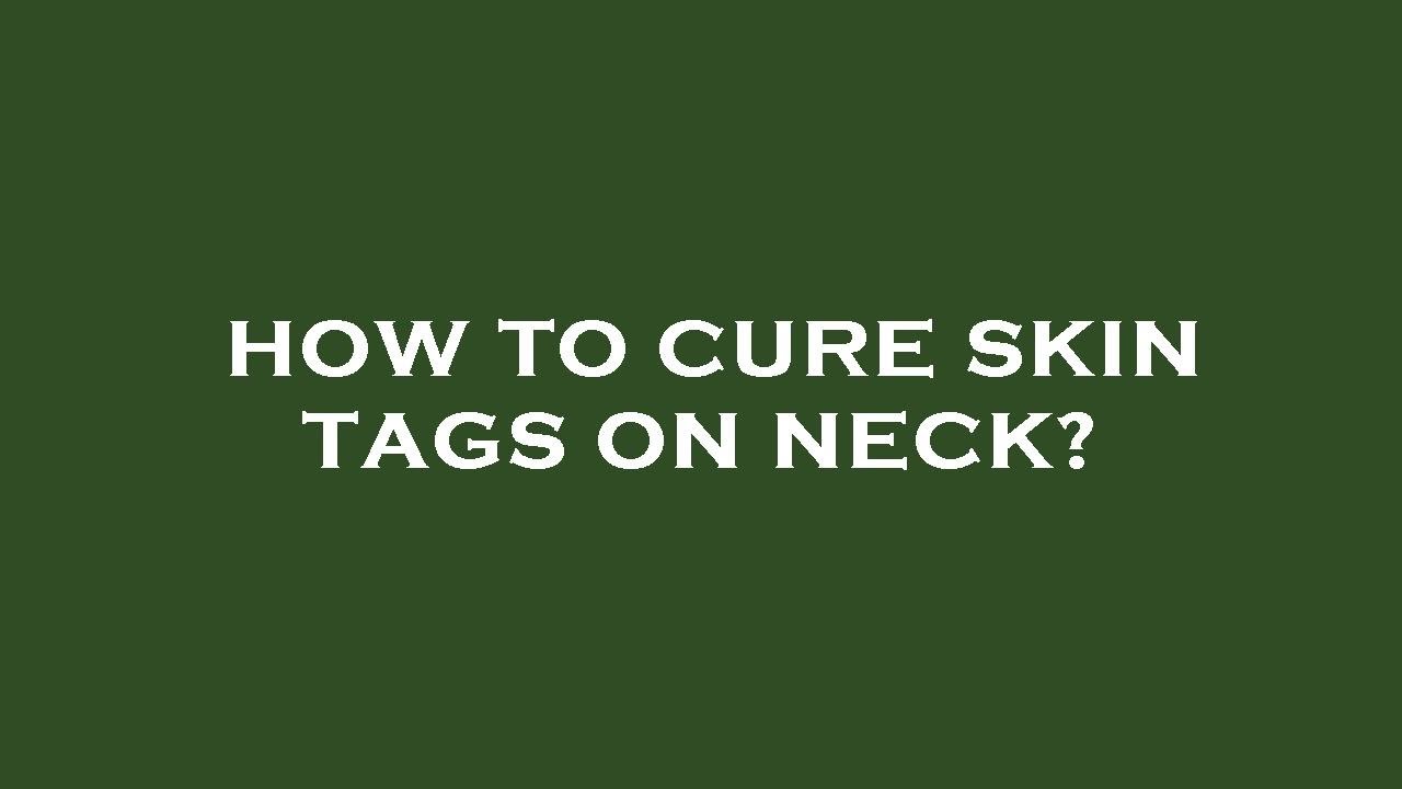 How to cure skin tags on neck? - YouTube