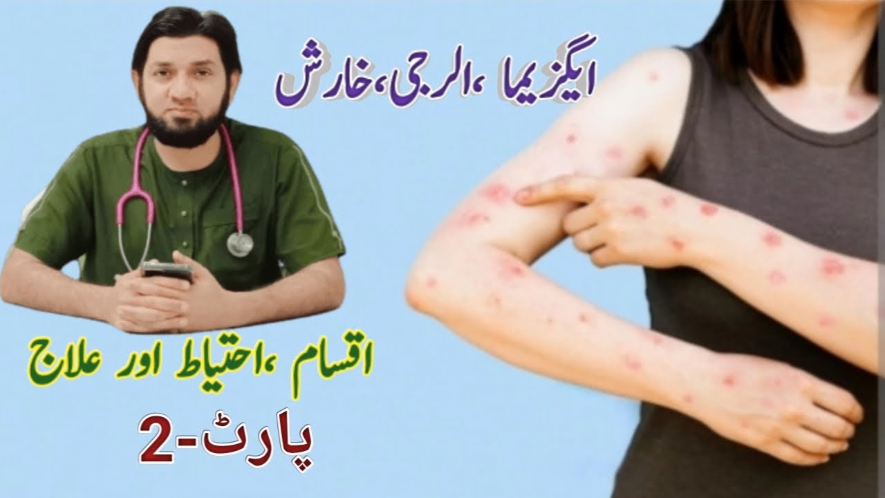 Eczema kharish ka ilaj/ایکزیما ،علامات،احتیاط اور علاج ...