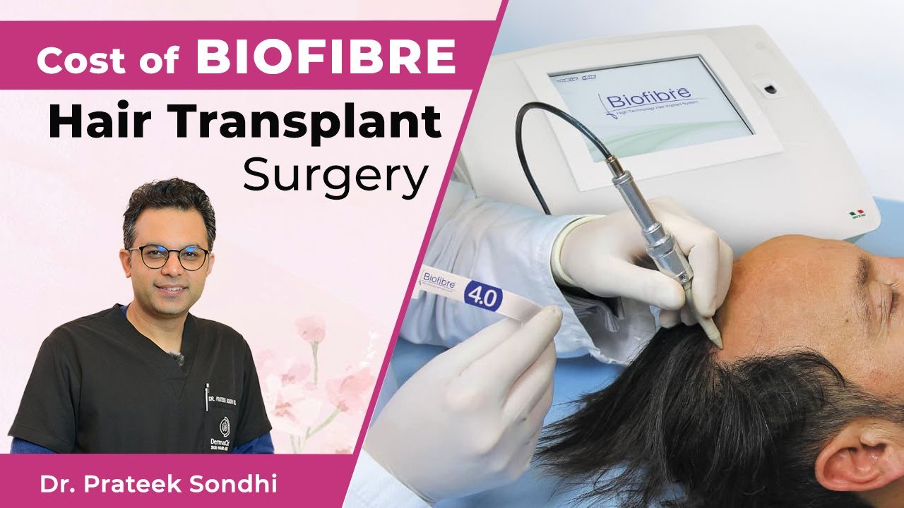 Cost of Biofibre hair transplant surgery | Derma Circles - YouTube