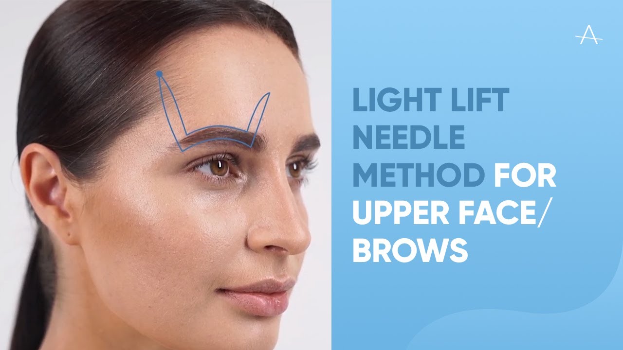 Light Lift NEEDLE METHOD for upper face/brows - YouTube