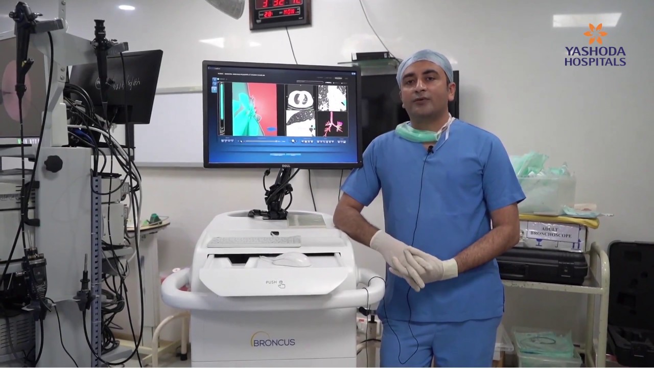 Early Diagnosis of Lung Cancer Using Navigational Bronchoscope | Lung ...