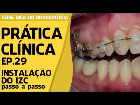COMO INSTALAR O IZC? PASSO A PASSO I EP. 29 I PROF. RODRIGO MILANI ...