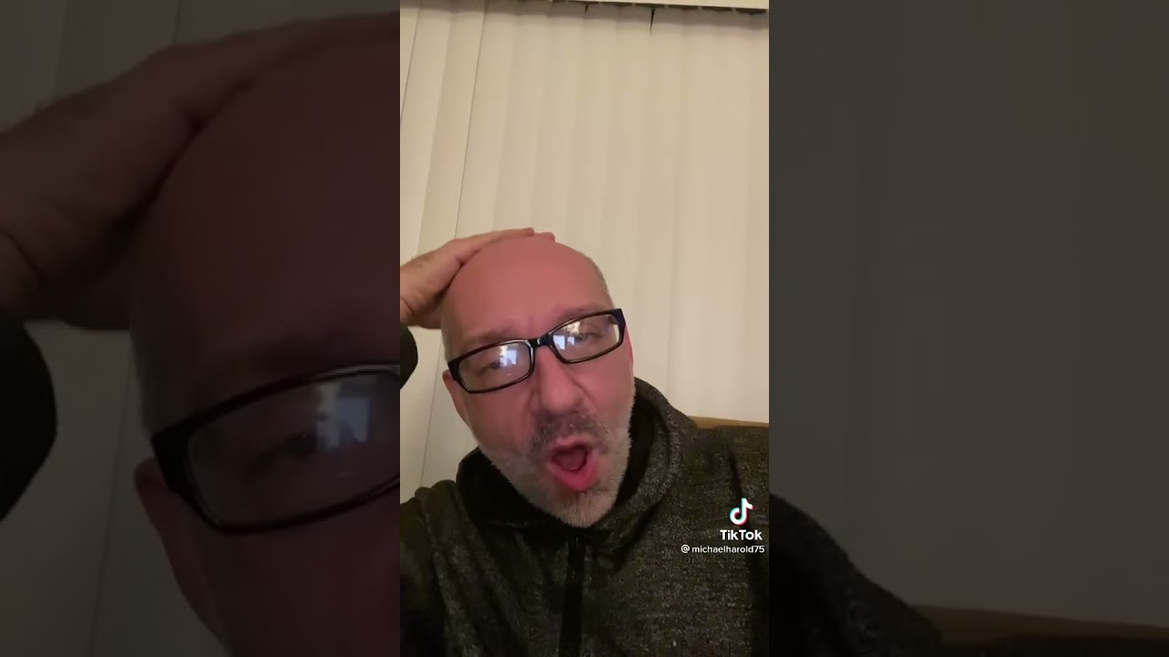bald guy dies of head slap lmaoooo bye old man - YouTube