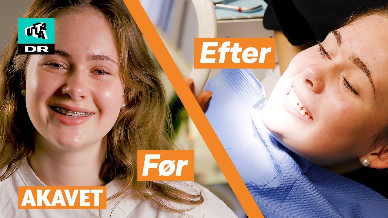 Ser sig selv uden bøjle for første gang! | Akavet - YouTube