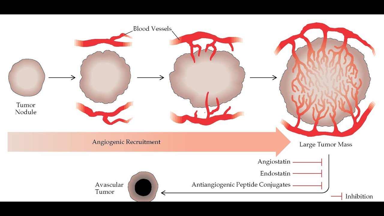 Development of sustained Angiogenesis Blood supply in Cancer - YouTube
