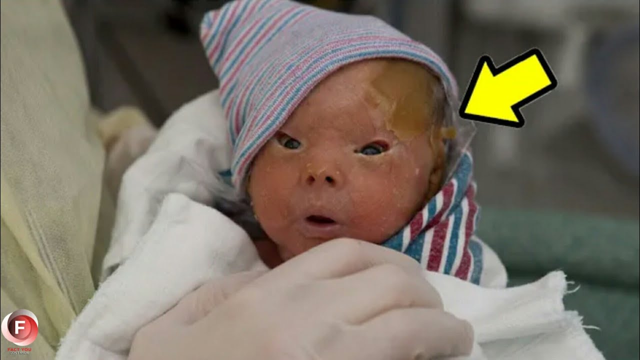 This Girl born with rare APPEARANCE and SHOCKS PARENTS, so they decide ...