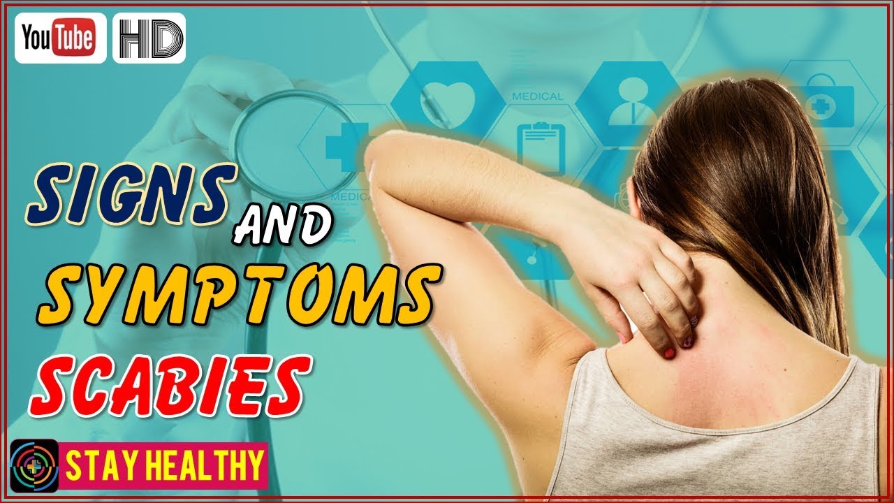 10 Signs of Scabies: what symptoms of Scabies - YouTube