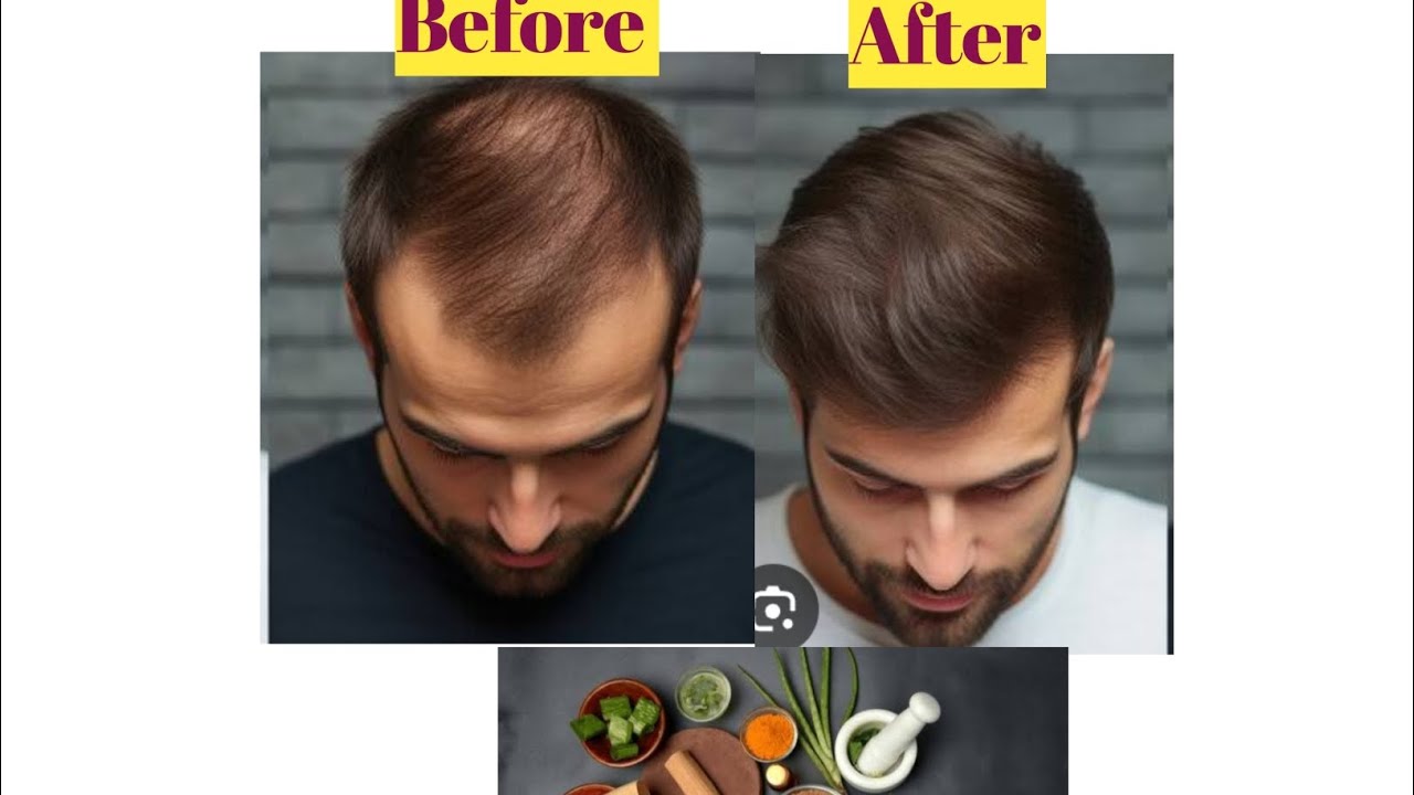 Hair growth tips - YouTube