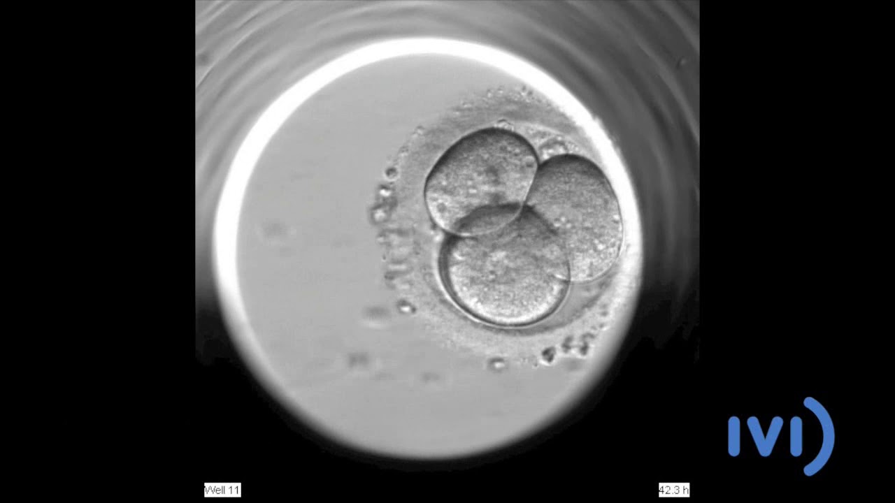 O Time-Lapse (embryoscope) | IPGO - YouTube