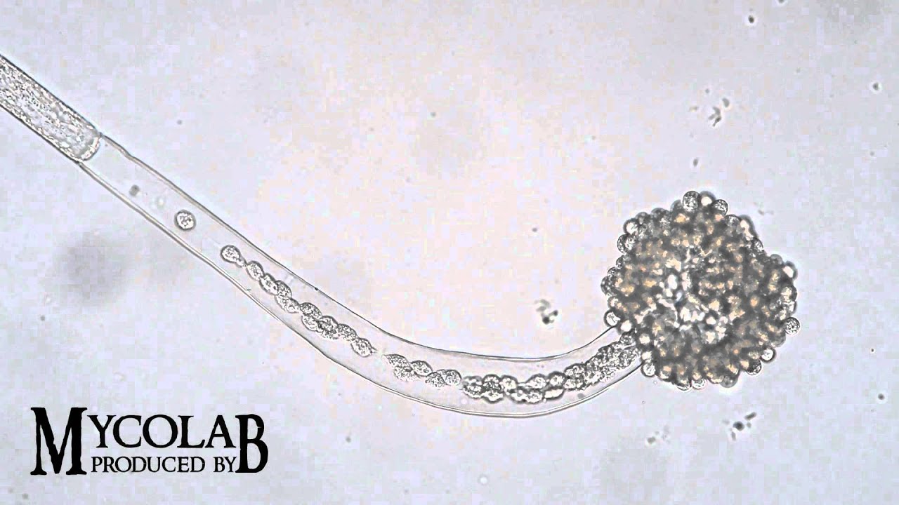 水生菌釋放系列- Achlya sp. - YouTube
