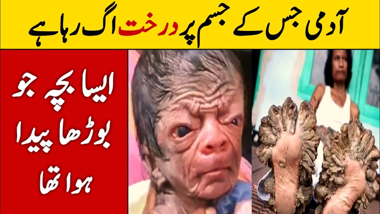 5 Unique People in the World | Dunya ky Ajeeb o Ghareeb insan - YouTube