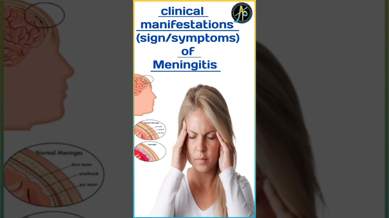 meningitis II triad sign of meningitis - YouTube