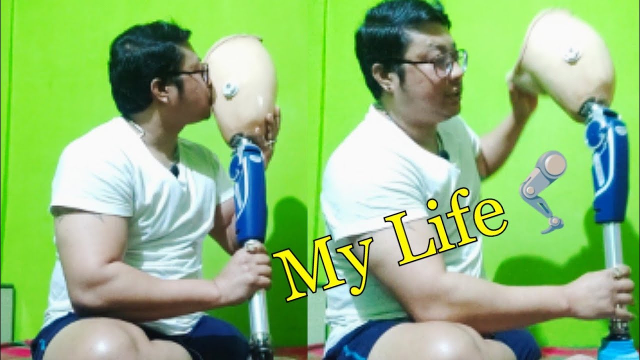 #ottobock #3r80 #amputee My Prosthetic Leg🦿 Ottobock 3r80 Knee || Eigi ...