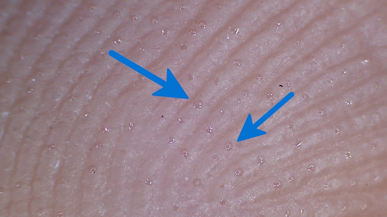 Sweating Under the Microscope! - YouTube