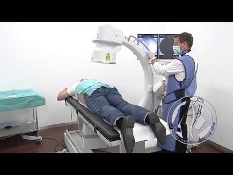 APEX SPINE - Das Wirbelsäulenzentrum - YouTube
