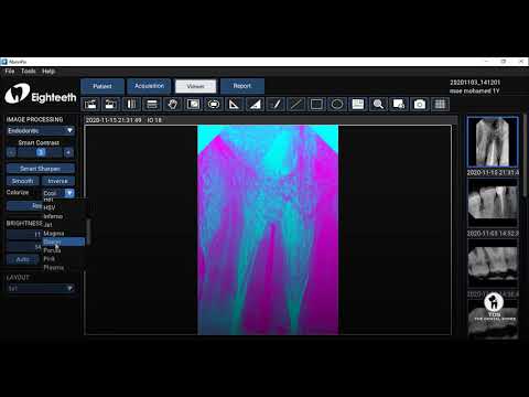 Tutorial - The Complete Guide To NanoPix X-Ray Sensor Software By Dr.Mohamed Tawakol - TDS, Egypt