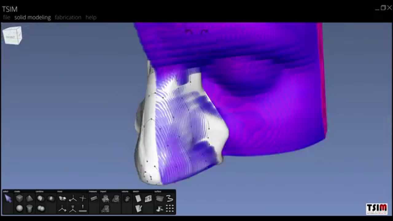 3D Printing a Model of a Patient’s Nose - YouTube