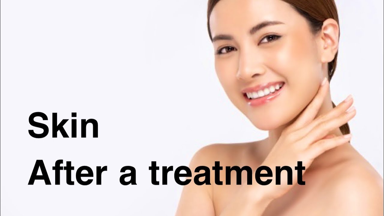 What to expect after having an electrolysis treatment - YouTube