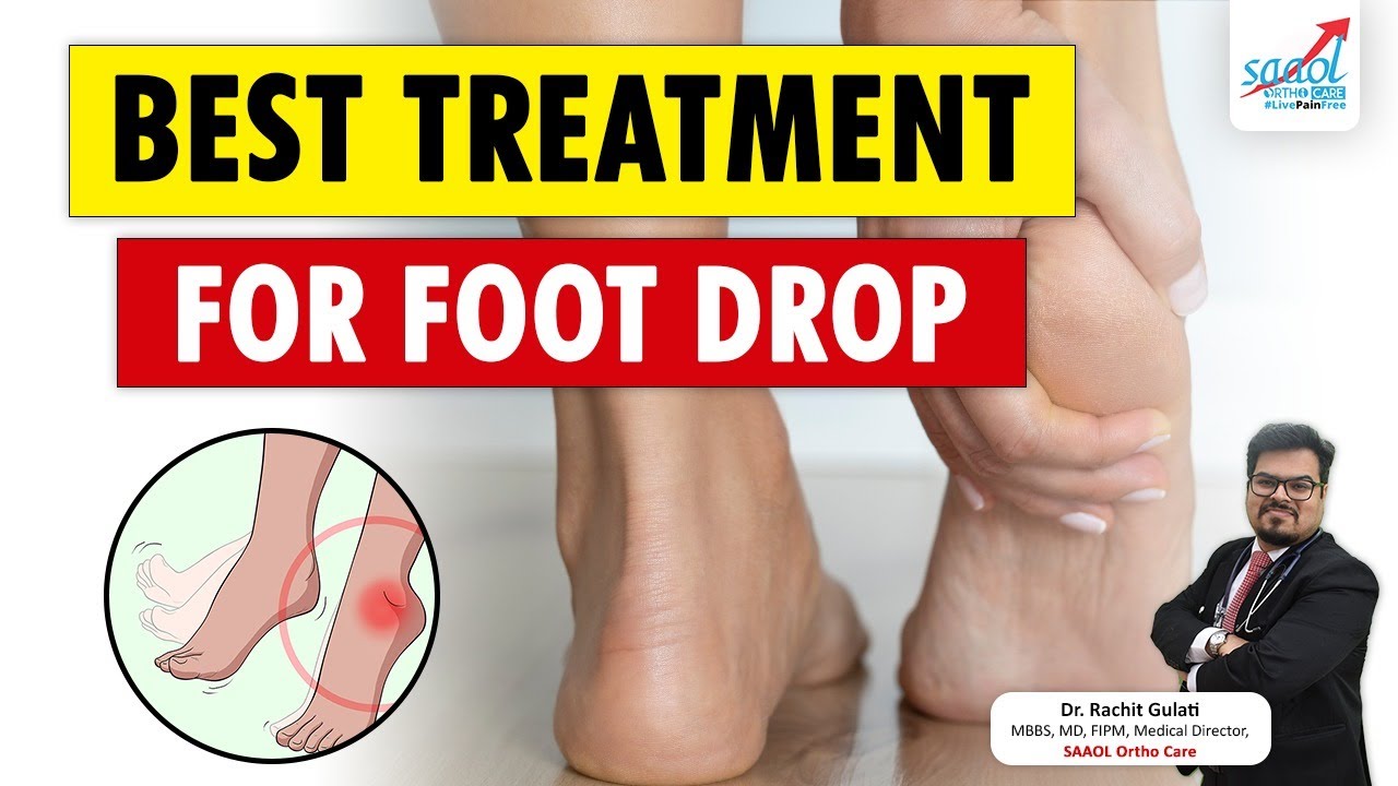 Foot Drop | Best Treatment | Best Exercises | Dr. Rachit Gulati | SAAOL ...