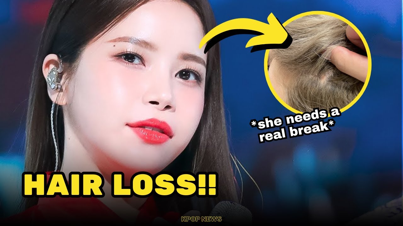 MAMAMOO Solar Gained Attention for Revealing Hair Loss Due to Stress # ...