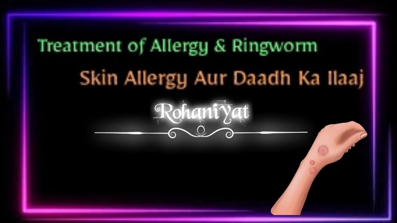 Treatment of Ringworm & Allergy | Treatment of Daadh & Allergy ...