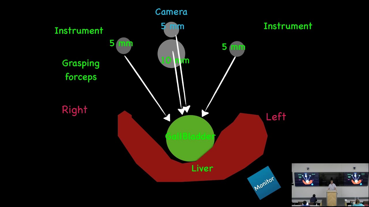 Laparoscopic Cholecystectomy in Dogs - YouTube