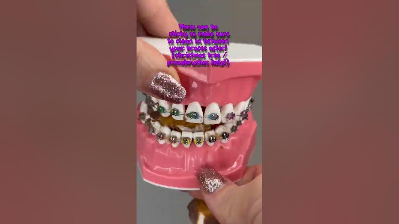 CANDY YOU CAN EAT WITH BRACES WINTER EDITION YouTube candy-you-can-eat-with-braces-winter-edition-youtube