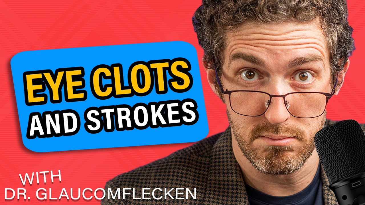 Blood Clots In The Eye | Knock Knock Eye - YouTube