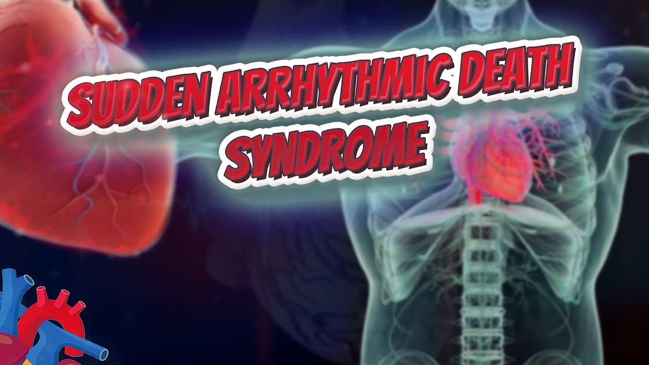Sudden arrhythmic death syndrome - Human Heart ️ and Cardiology ️🔊 ...