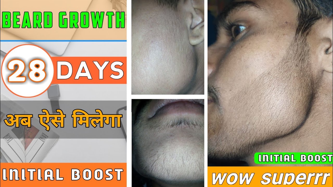 BEARD GROWTH || 28 days | full beard growth || अब ऐसे मिलेगा - Initial ...