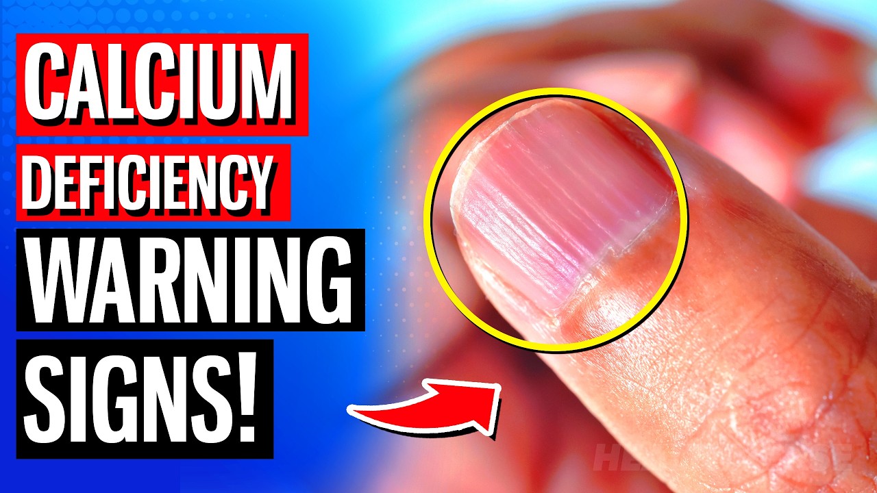 10 ALARMING Signs You Have A CALCIUM DEFICIENCY! - YouTube