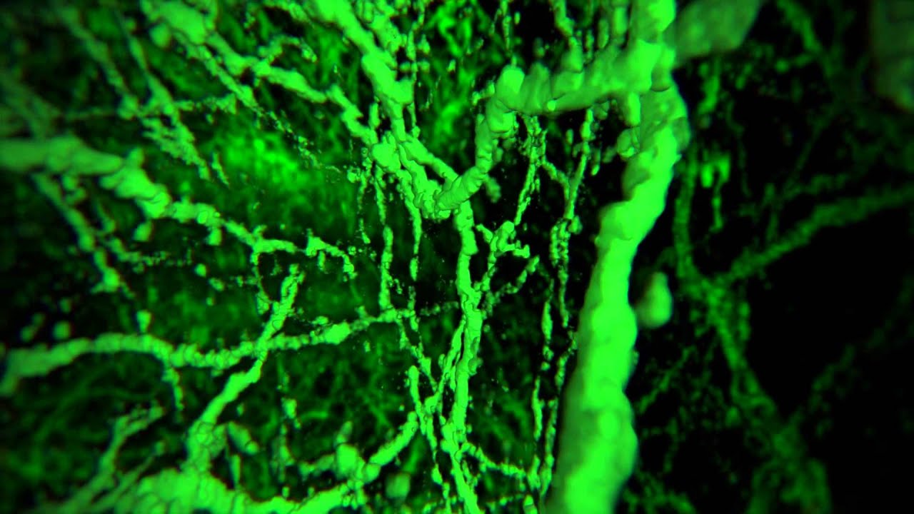 Journey into an swollen brain - YouTube