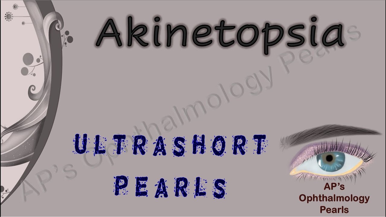 Ultrashort Pearls 7 │Akinetopsia - YouTube