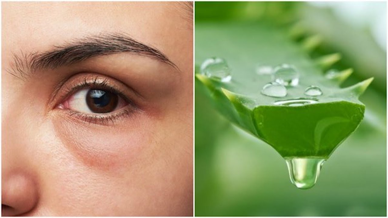 Ingredient Will Cure Your Eye Problems Naturally And Improve Your ...